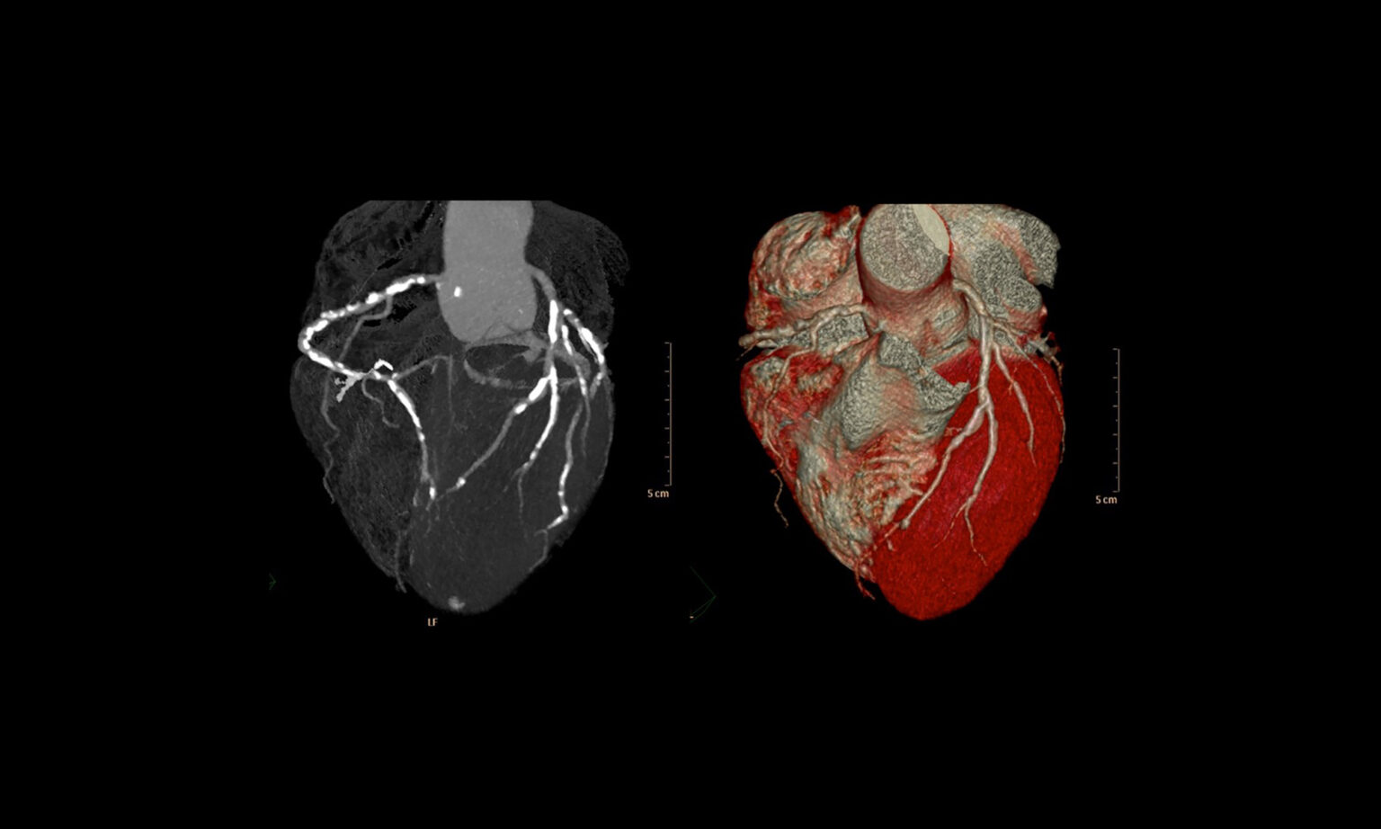 CARDIOVIEW - Frühzeitige Diagnostik kann Leben retten